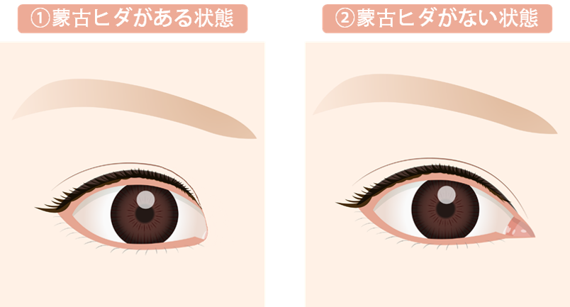 蒙古襞がある芸能人31選・女性男性別！特徴やルーツ・目頭切開との見分け方も徹底解説【最新版】